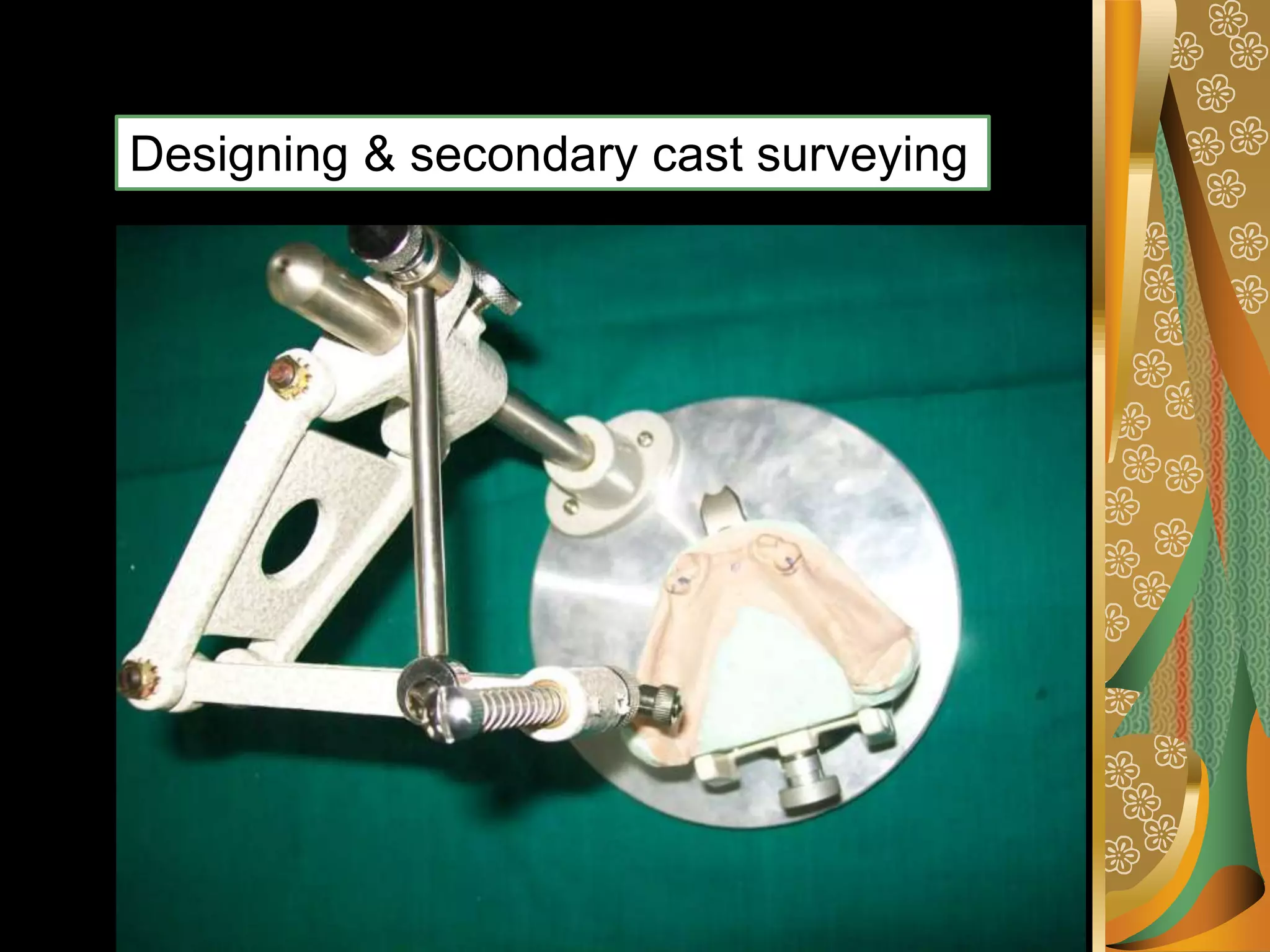 Kennedy classification | PPTX