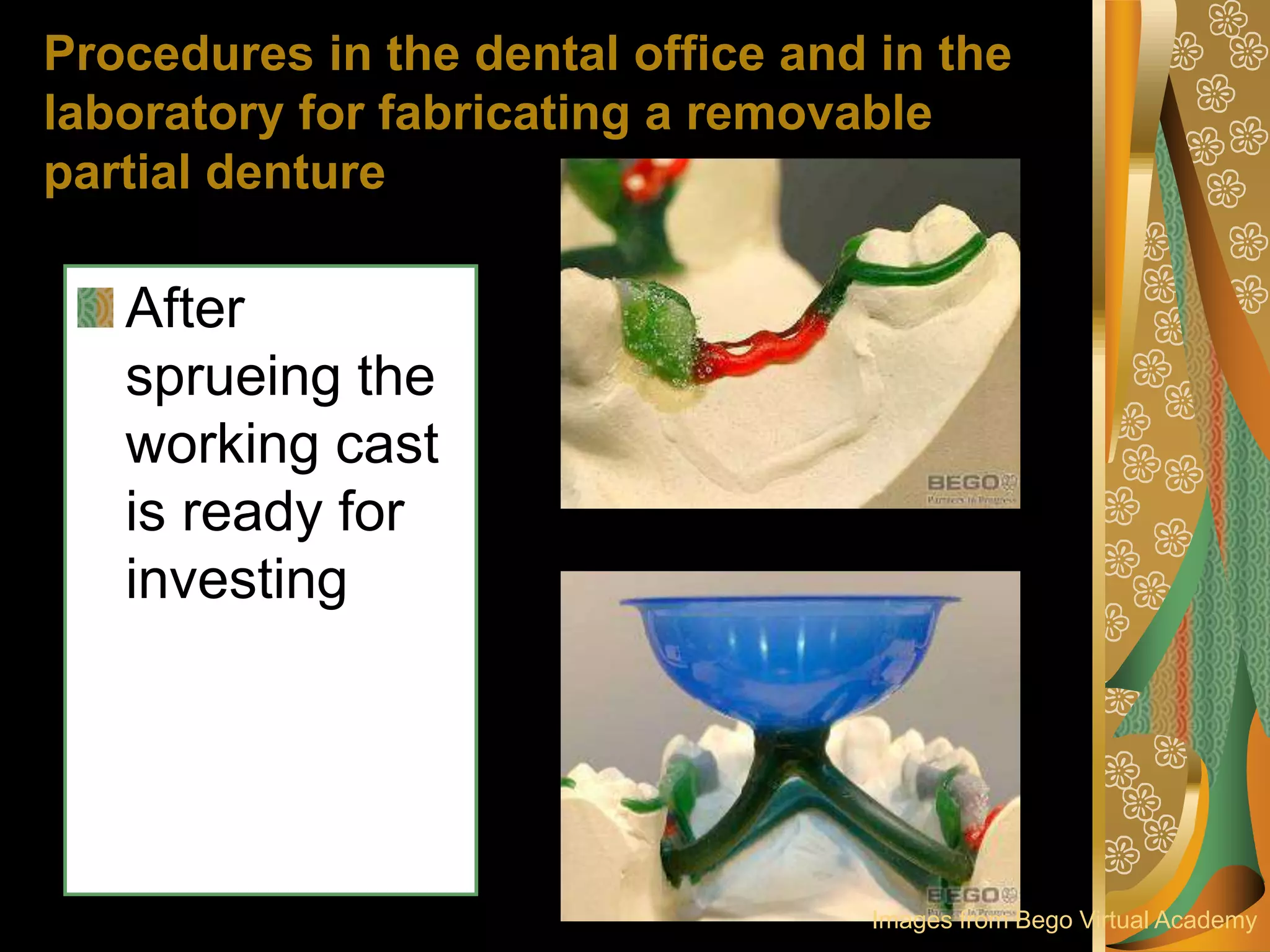 Kennedy classification | PPTX