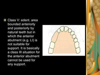 Kennedy classification | PPTX