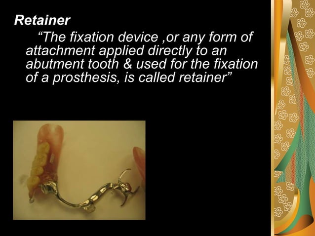 Kennedy classification | PPTX