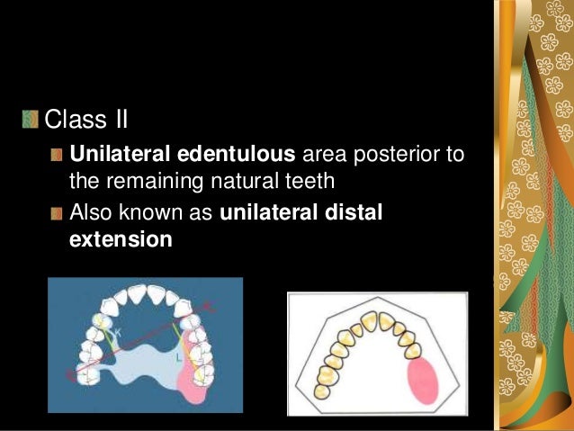 Kennedy classification