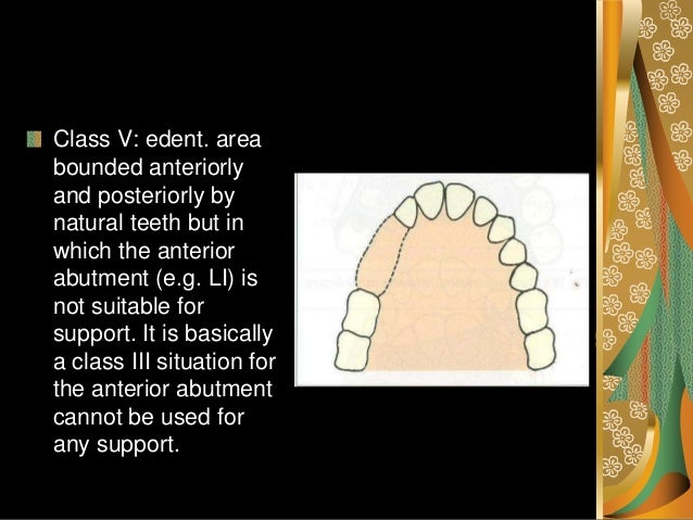 Kennedy classification