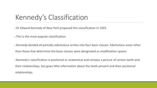 Kennedy’s Classification in Cast Partial Denture | PPTX