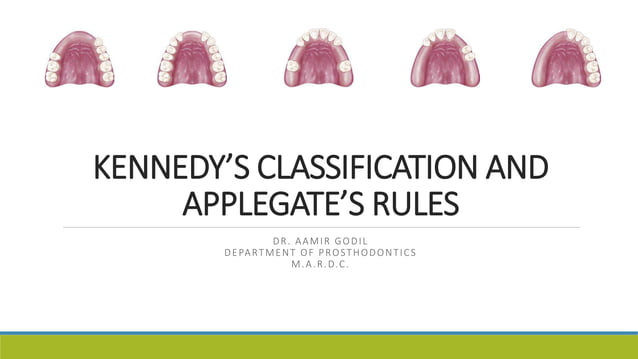 Kennedy’s Classification in Cast Partial Denture | PPT