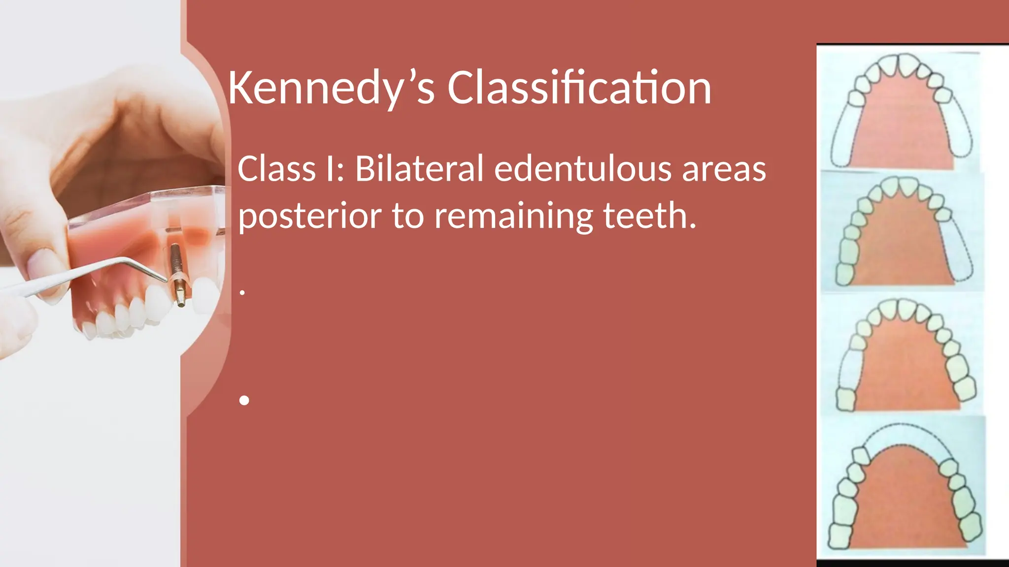 Kennedy's classification copy[1] - Read-Only.pptx