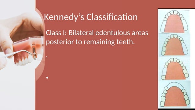 Kennedy's classification copy[1] - Read-Only.pptx