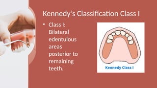 Kennedy's classification copy[1] - Read-Only.pptx
