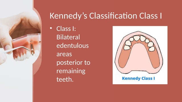 Kennedy's classification copy[1] - Read-Only.pptx