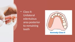 Kennedy's classification copy[1] - Read-Only.pptx