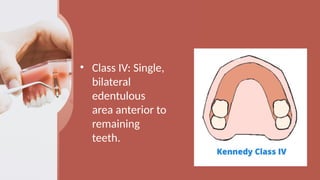 Kennedy's classification copy[1] - Read-Only.pptx