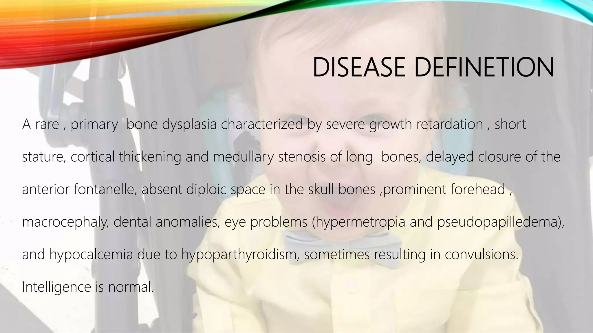 Kenny Caffey Syndrome | PPTX