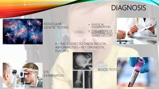 Kenny Caffey Syndrome | PPTX