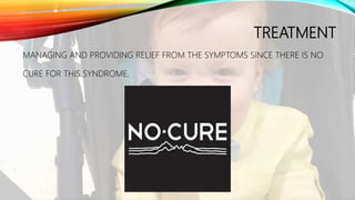 Kenny Caffey Syndrome | PPTX