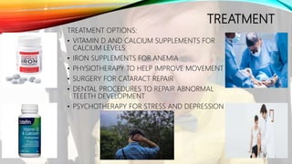 Kenny Caffey Syndrome | PPTX