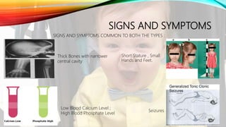 Kenny Caffey Syndrome | PPTX