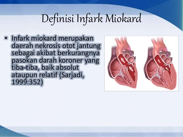 Kep.kar infark miokard