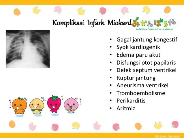 Kep.kar infark miokard