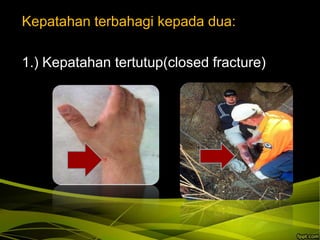 Kepatahan | PPT