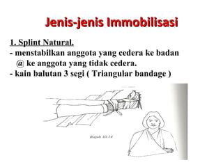 kepatahan-immobilisasi-transport-woundindustries-160117001352.pdf