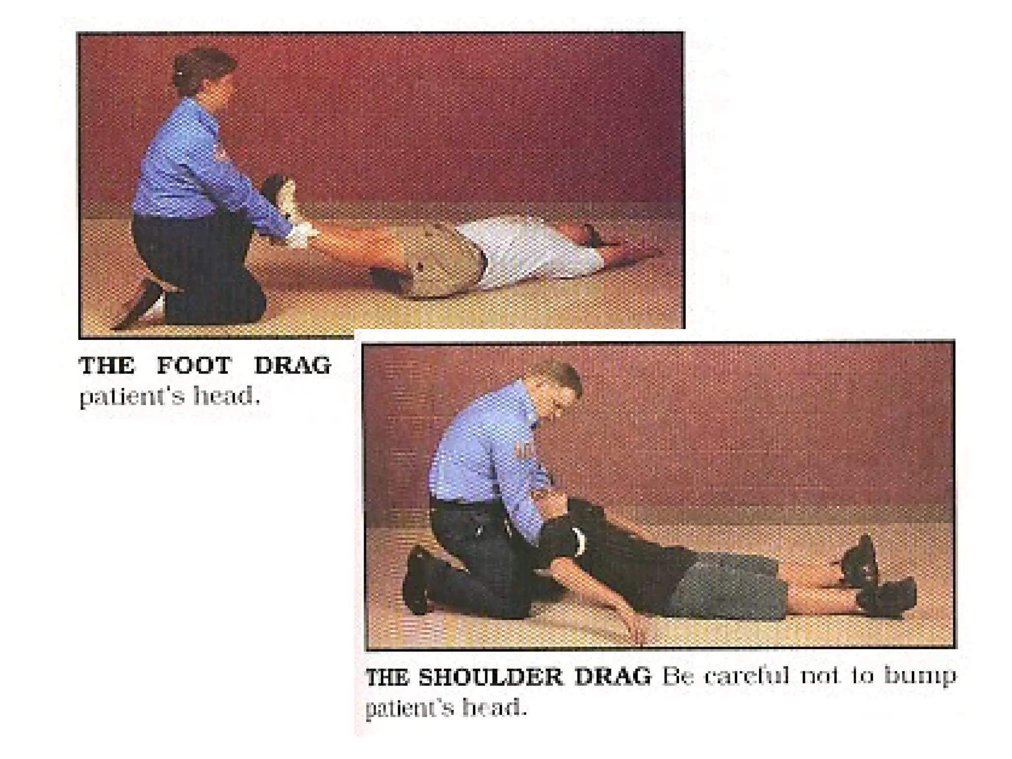 Kepatahan immobilisasi-transport-wound industries | PPT