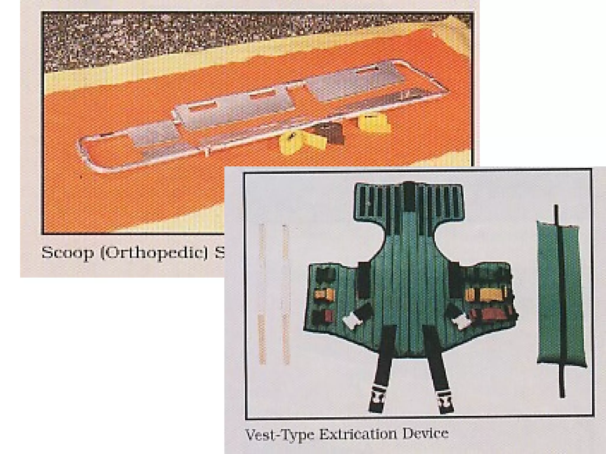 Kepatahan immobilisasi-transport-wound industries | PPT