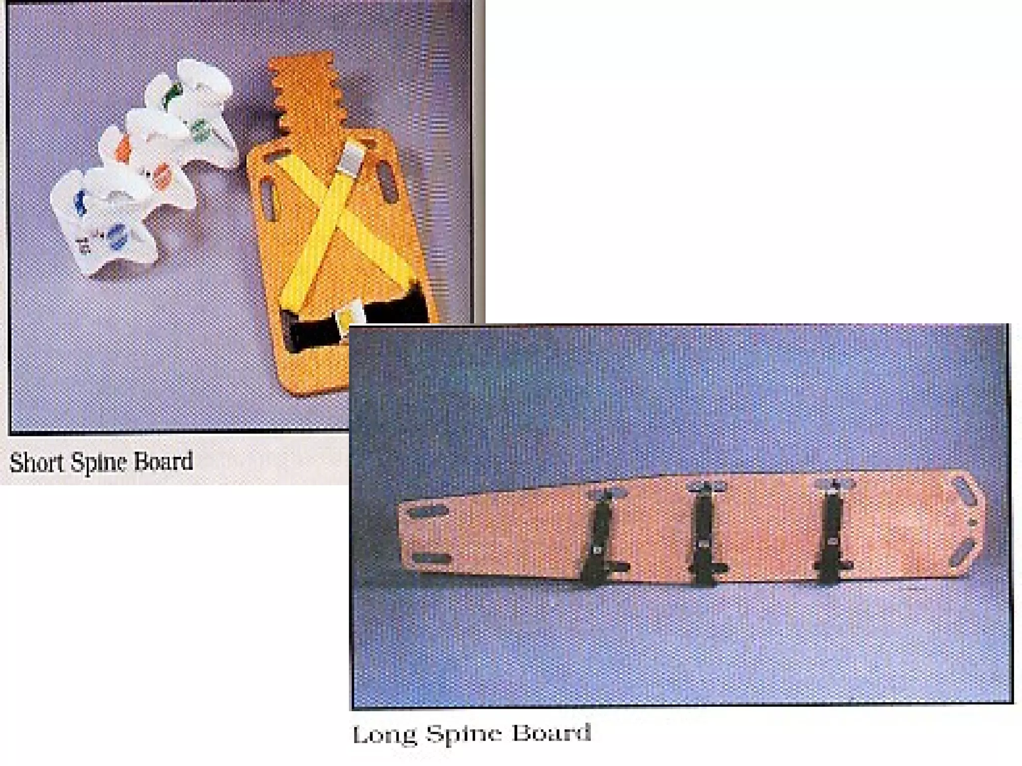 Kepatahan immobilisasi-transport-wound industries | PPT