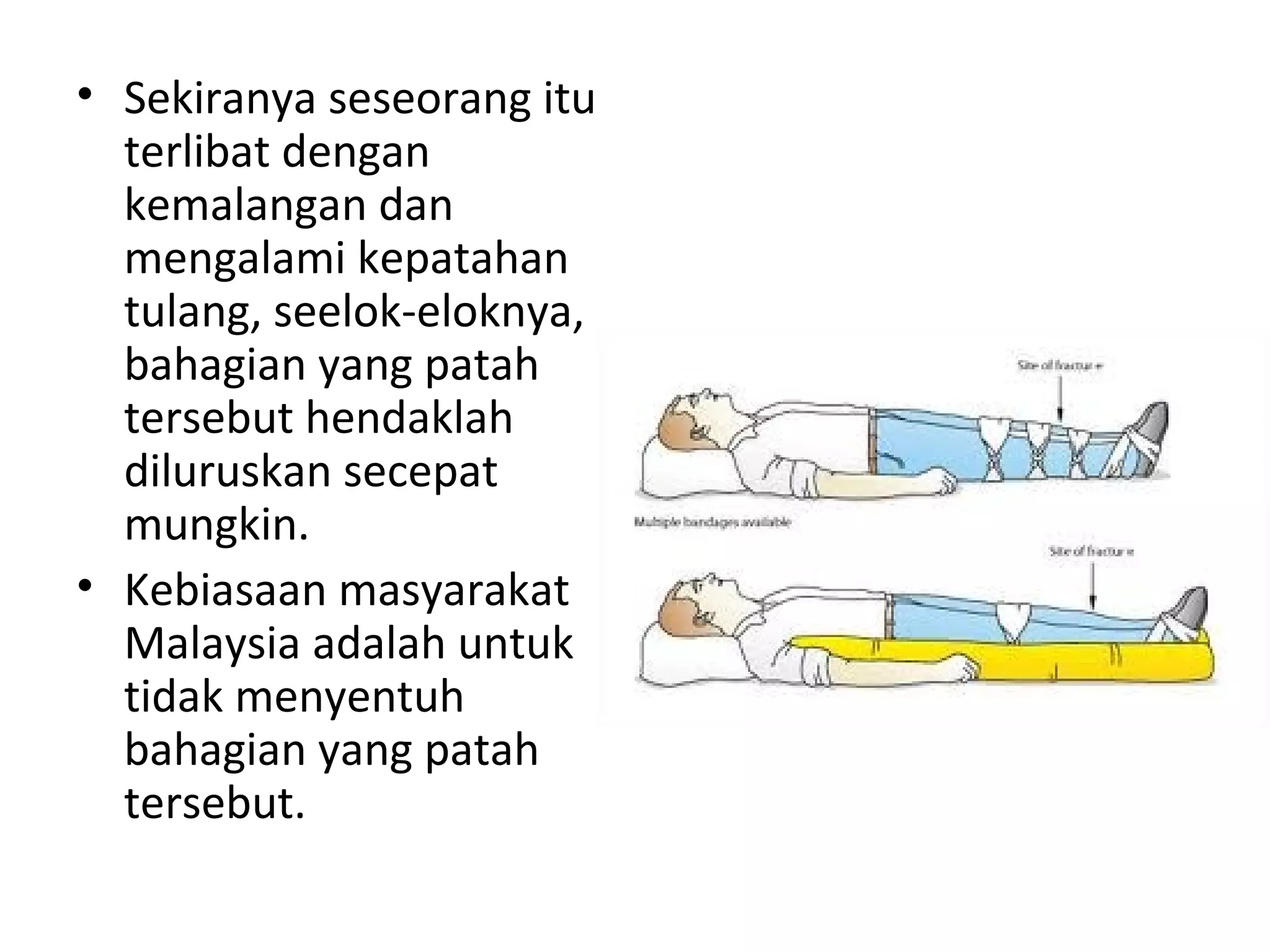 Kepatahan immobilisasi-transport-wound industries | PPT