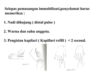 Kepatahan immobilisasi-transport-wound industries | PPT