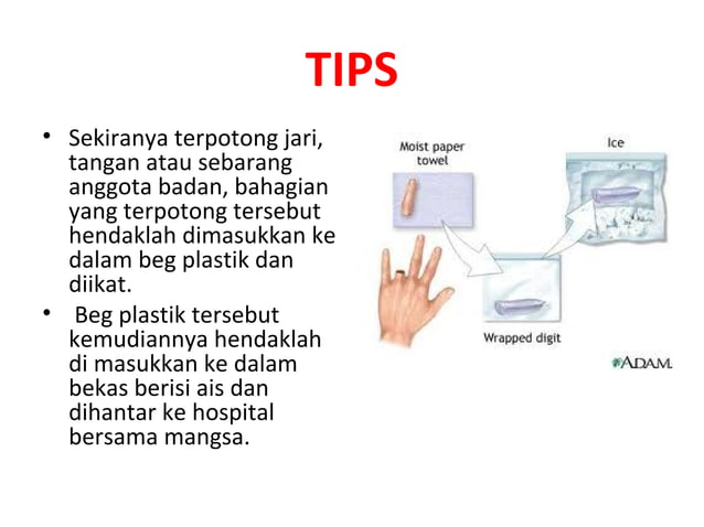Kepatahan immobilisasi-transport-wound industries | PPT