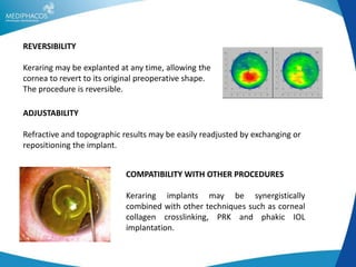 Keraring official presentation | PPT