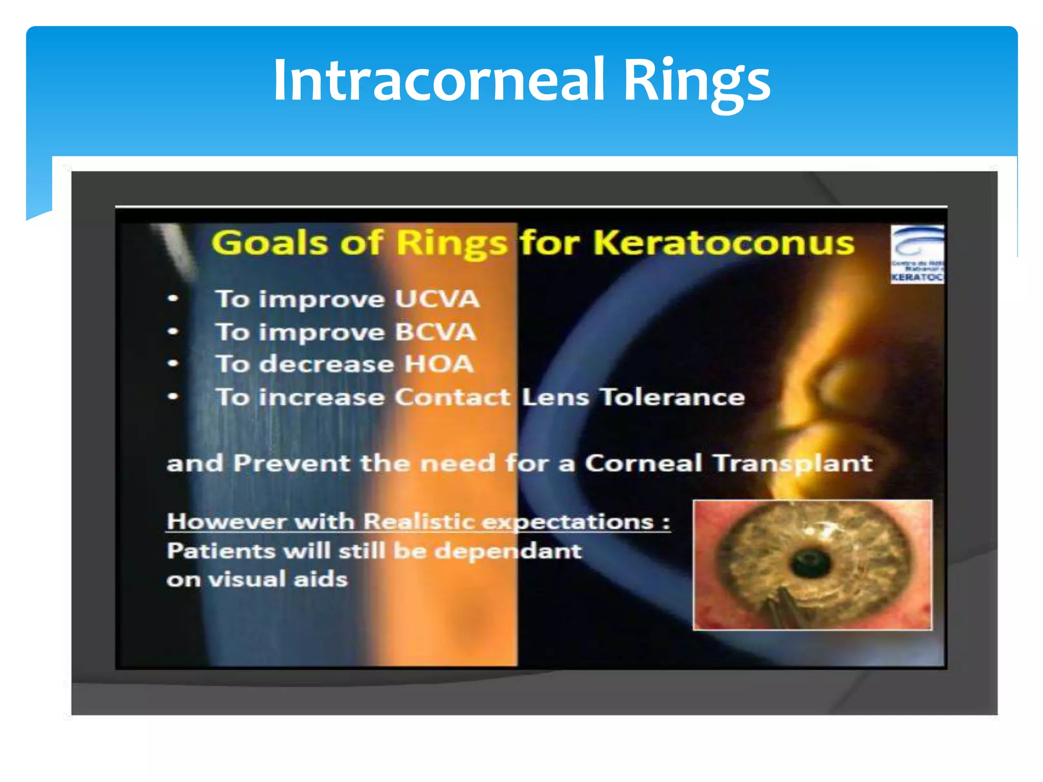 Kerarings complications | PPTX