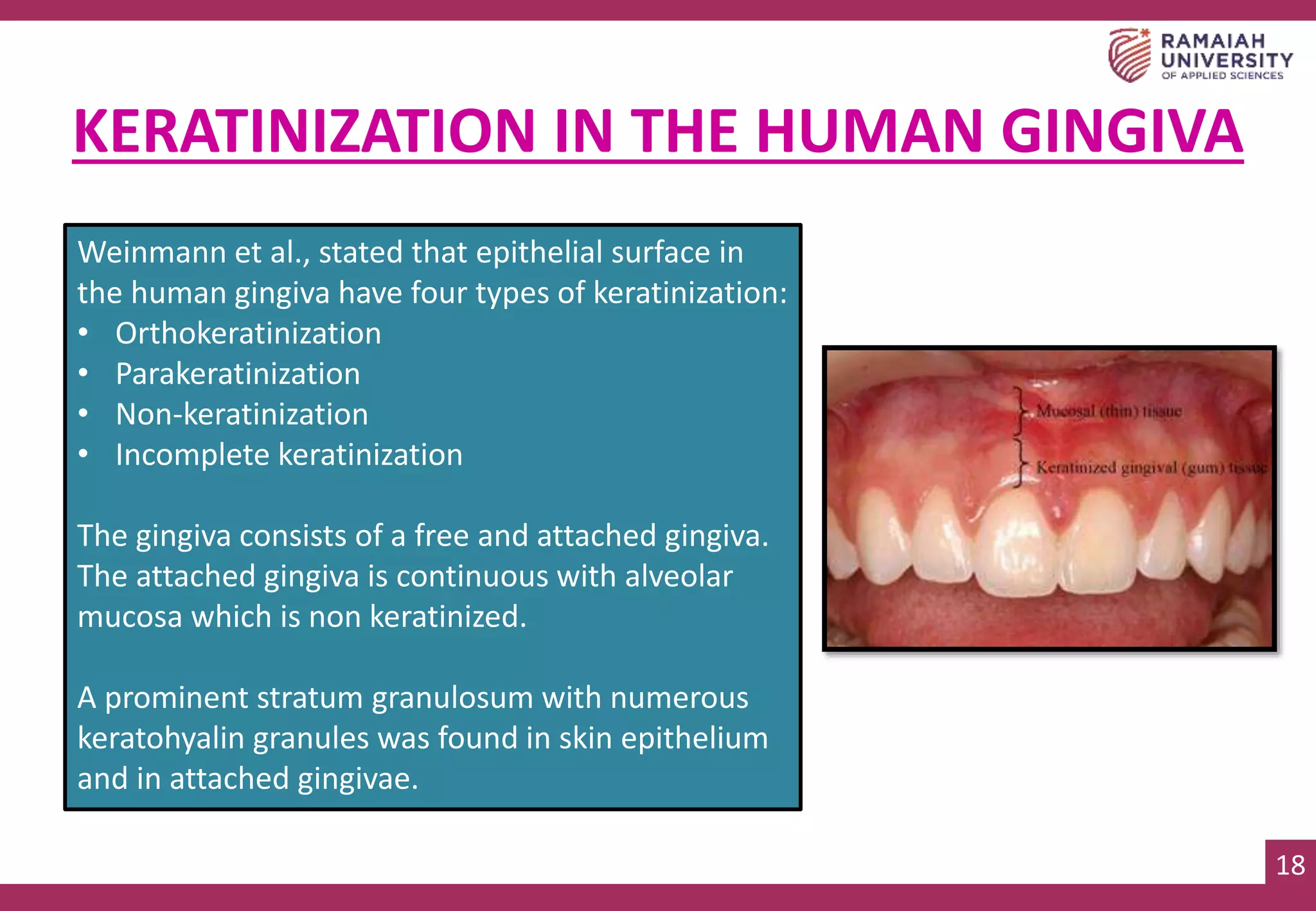 Gingival Keratinization | PPTX