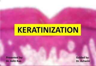 Gingival Keratinization | PPTX