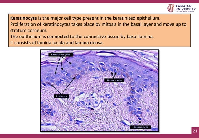 Gingival Keratinization | PPTX