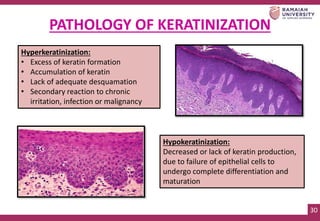 Gingival Keratinization | PPTX
