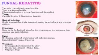Keratitis: Types, Pictures, And Treatment – RXDBBU