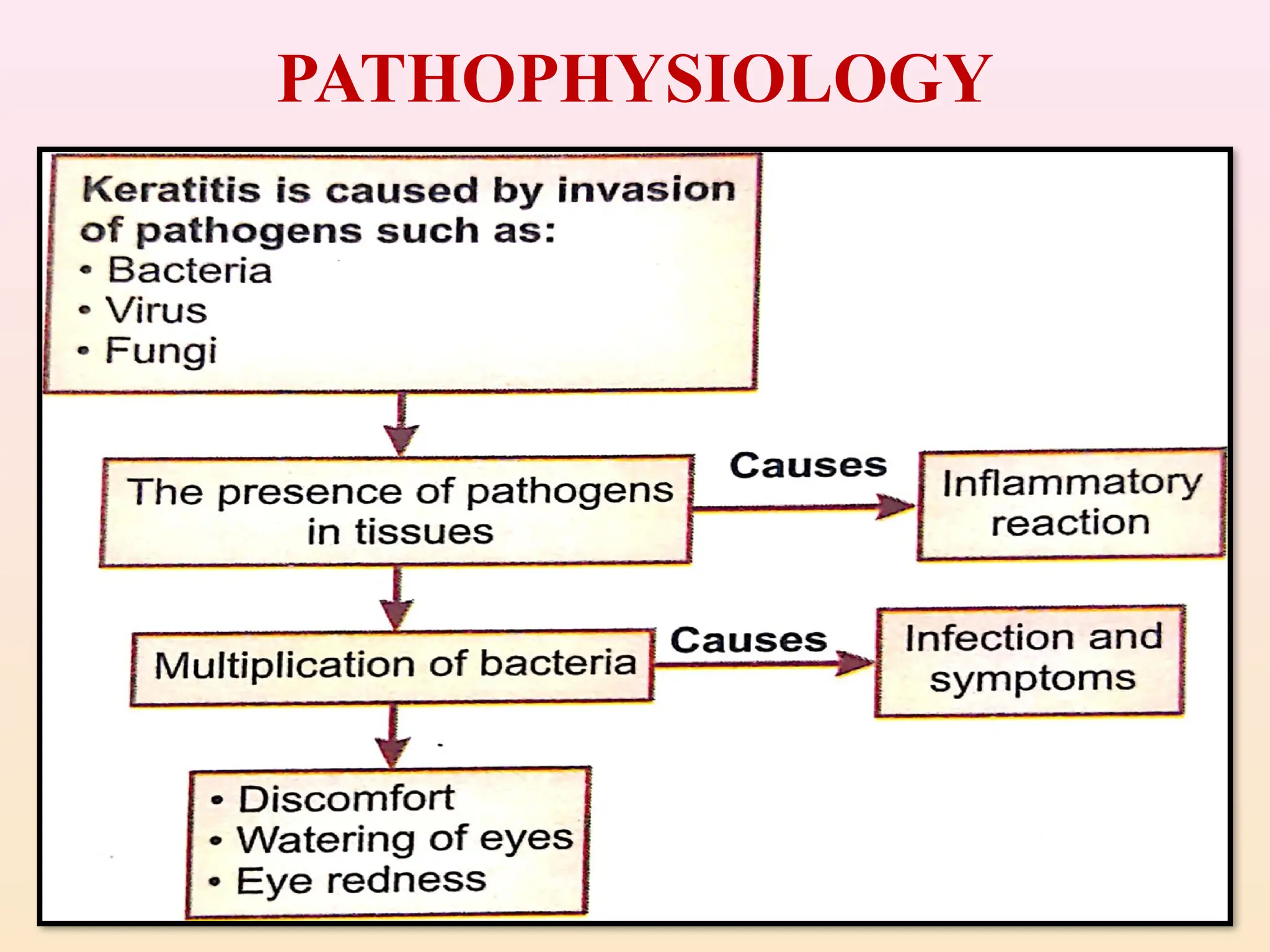 Keratitis, also known as corneal ulcer, is an inflammation of the ...