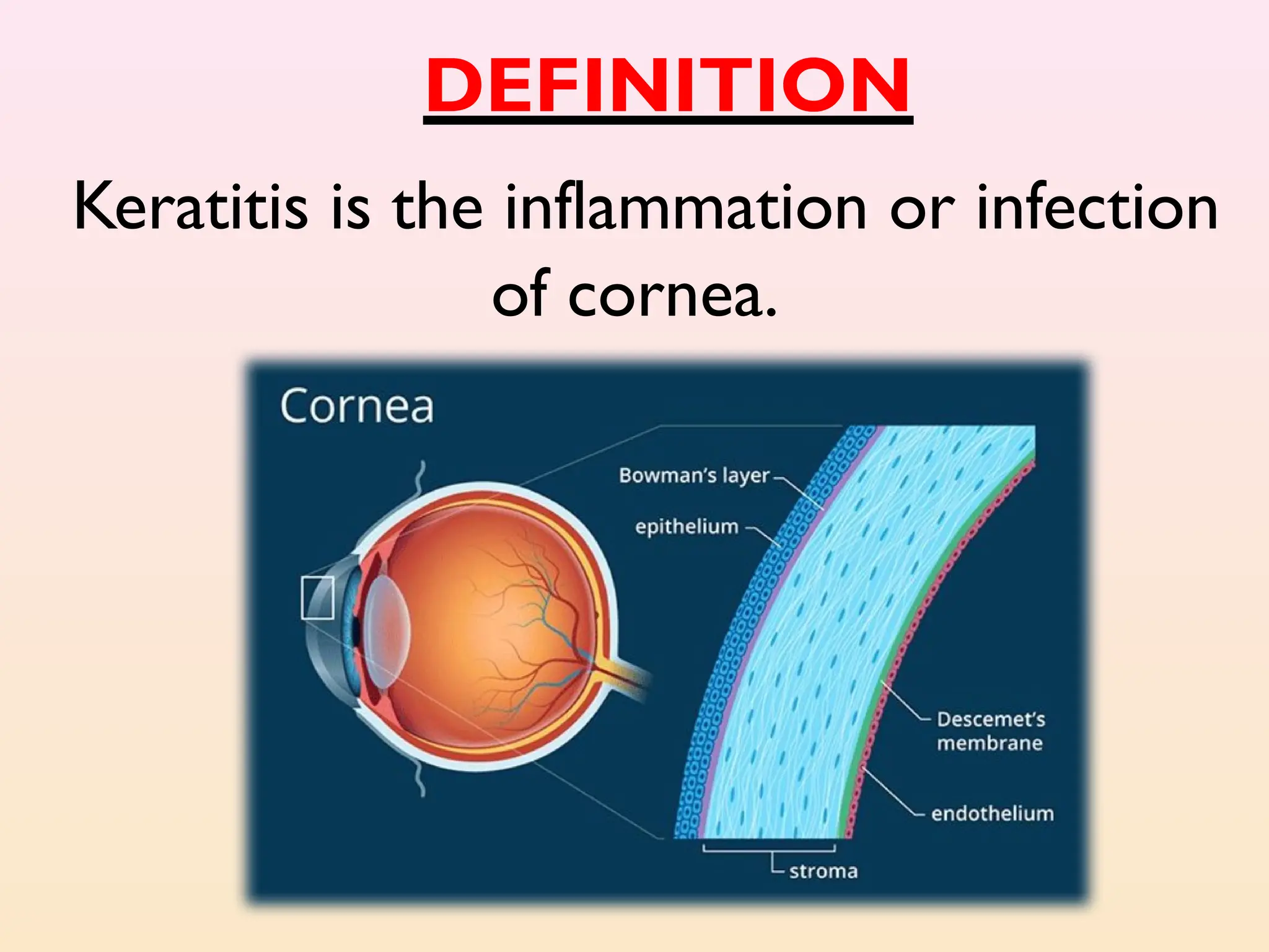 Keratitis, also known as corneal ulcer, is an inflammation of the ...