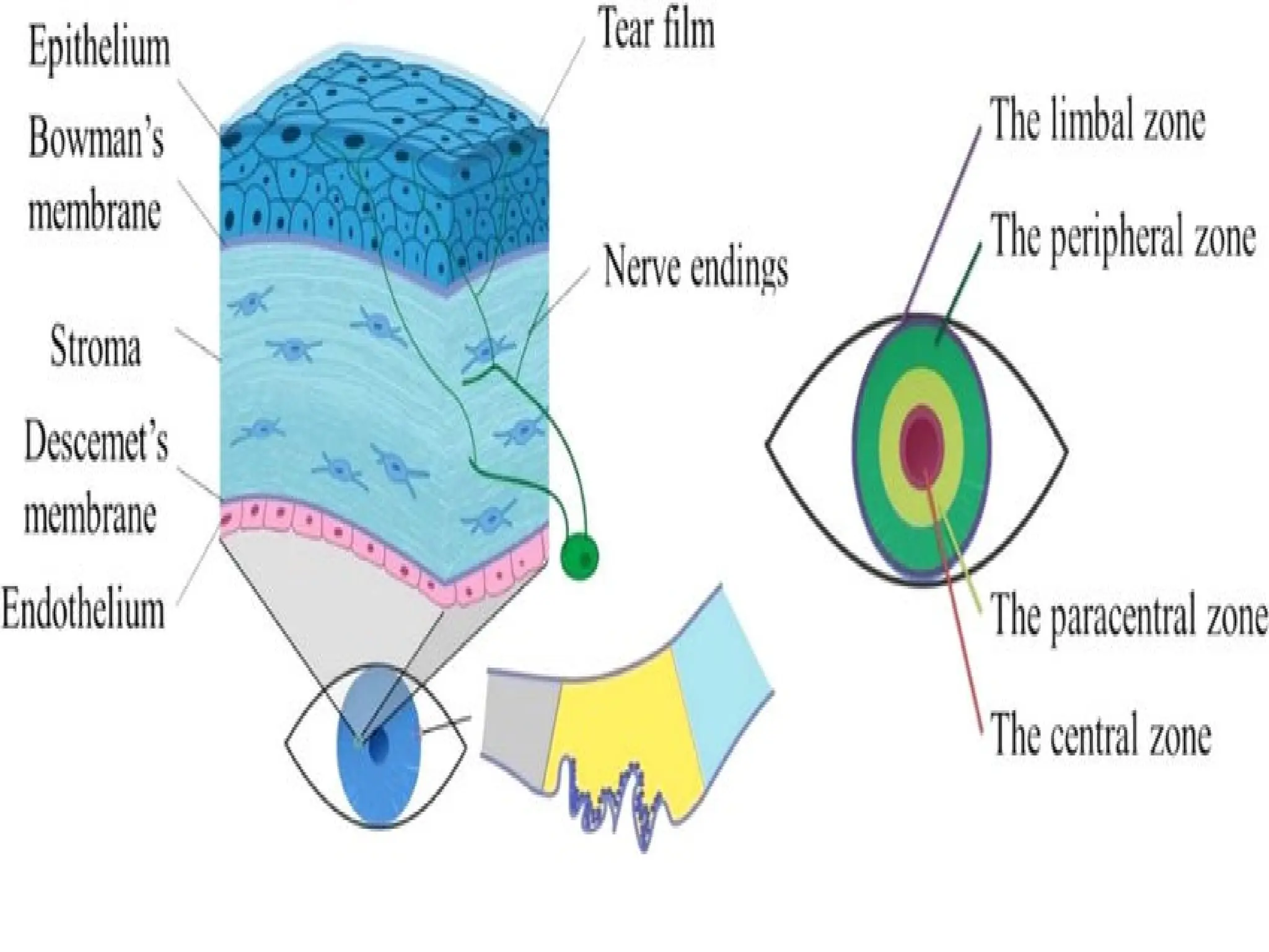 Keratitis, also known as corneal ulcer, is an inflammation of the ...