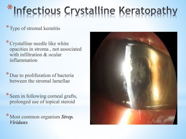 Approach To Microbial Keratitis - 1 | PPT