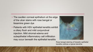 Keratitis HSV.pptx