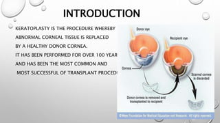 Keratoplasty | PPTX