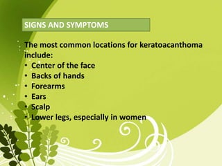 Keratoacanthoma | PPTX