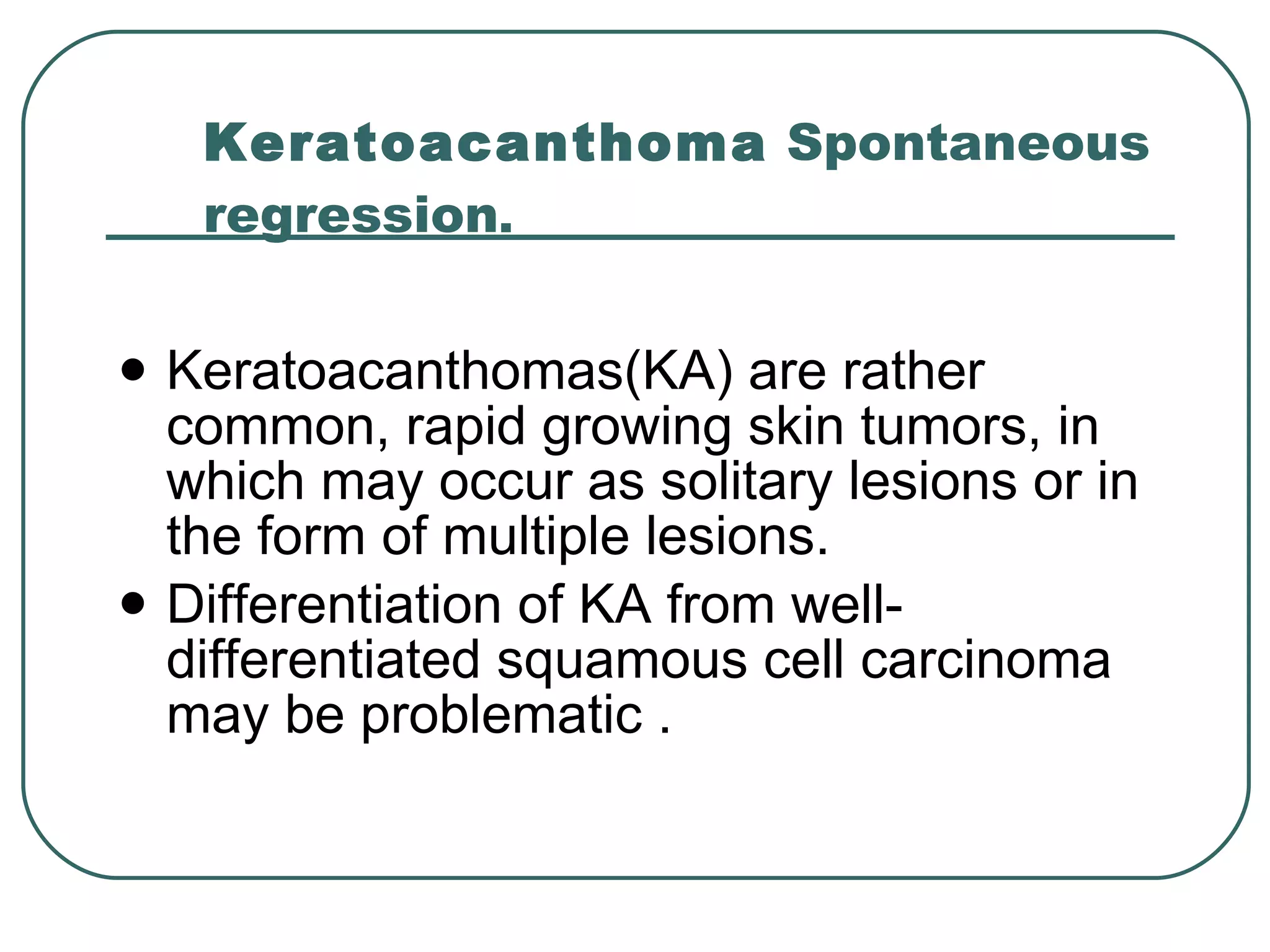 Keratoacanthoma. spontaneous regresion | PPT | Skin and Dermatology ...