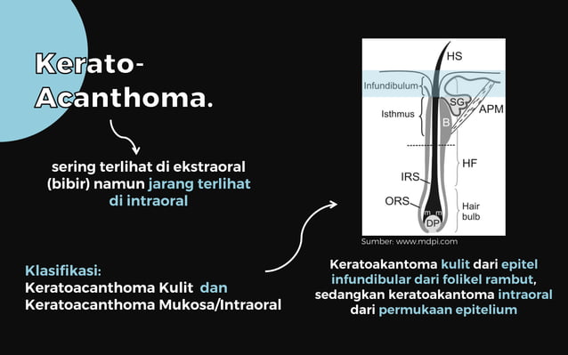 Keratoacanthoma of the tongue, a very unusual histopathology diagnosis ...