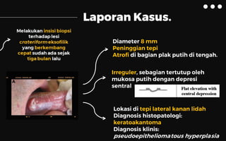 Keratoacanthoma of the tongue, a very unusual histopathology diagnosis ...
