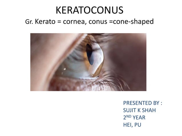 KERATOCONUS-1.pptx | Eye and Vision Conditions | Diseases and Conditions