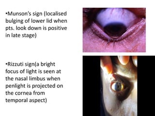 KERATOCONUS-1.pptx | Eye and Vision Conditions | Diseases and Conditions