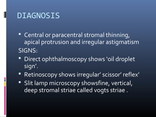 Keratoconus | PPT
