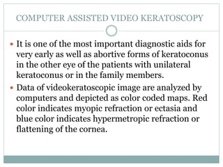 Keratoconus | PPTX